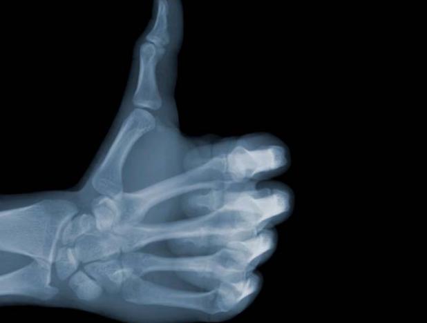 ¿Por qué los rayos X se llaman “equis”?